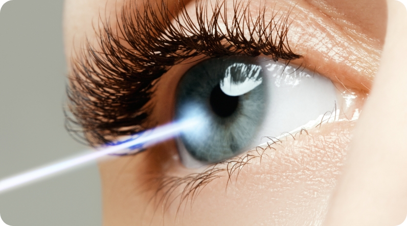 Iridotomia Com Yag Laser Dr Eduardo Leonel